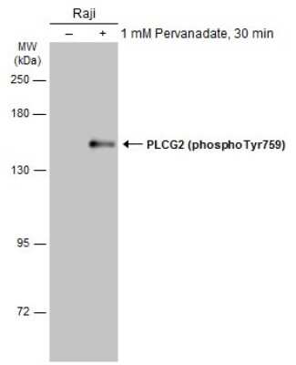 PLC-gamma 2 [p Tyr759] Antibody (NBP3-13241): Novus Biologicals